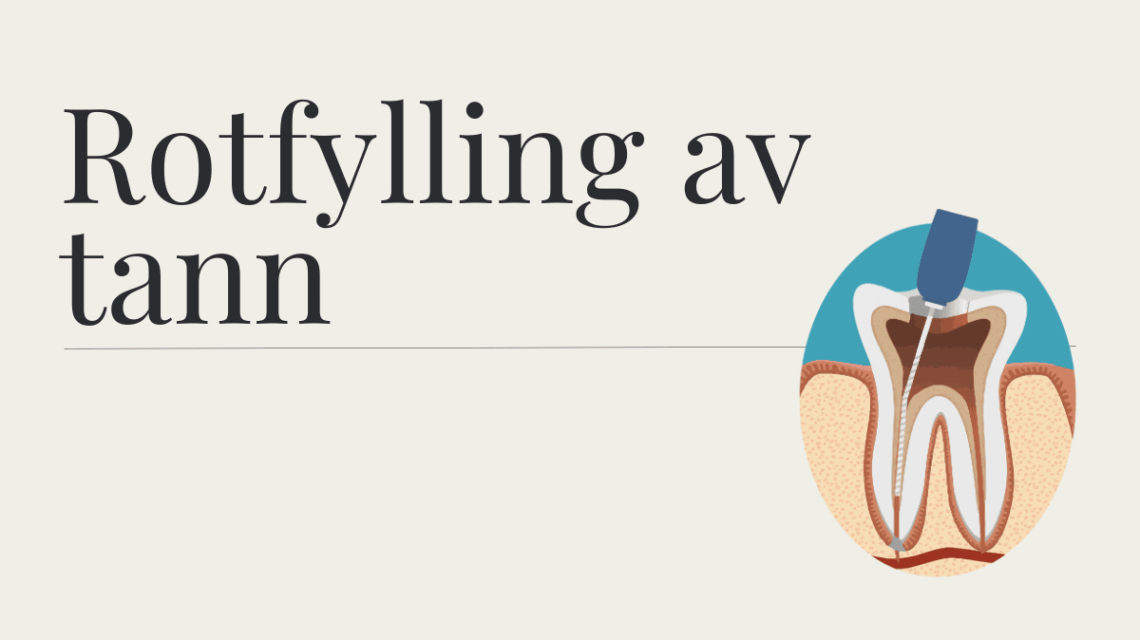 Rotfylling av tann: fortann, hjørnetann og jeksel (endo-behandling)