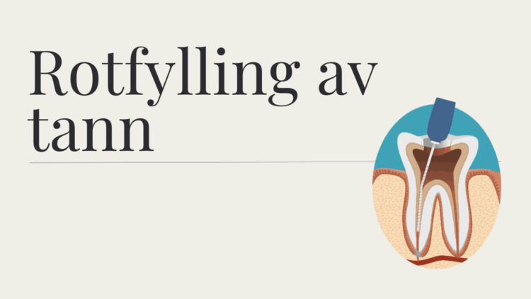 Rotfylling av tann: fortann, hjørnetann og jeksel (endo-behandling)